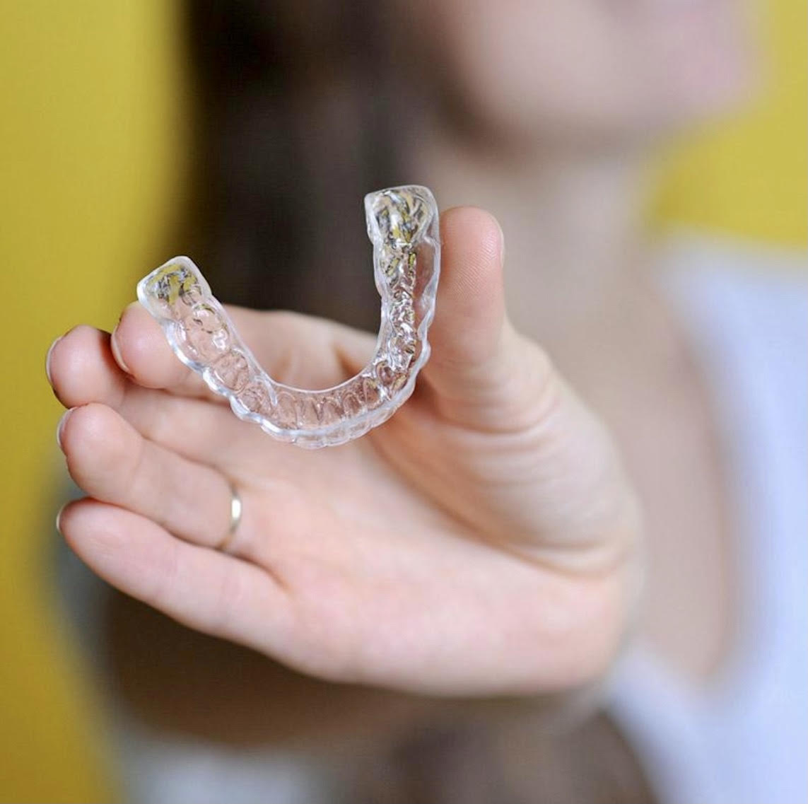 Making Dental Impressions for A Clear Retainer and NightGuard – The ...