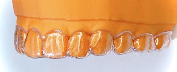 Premium Sculpted Clear Retainer, Buy One Get One 50% Off BOGO! Use cod ...