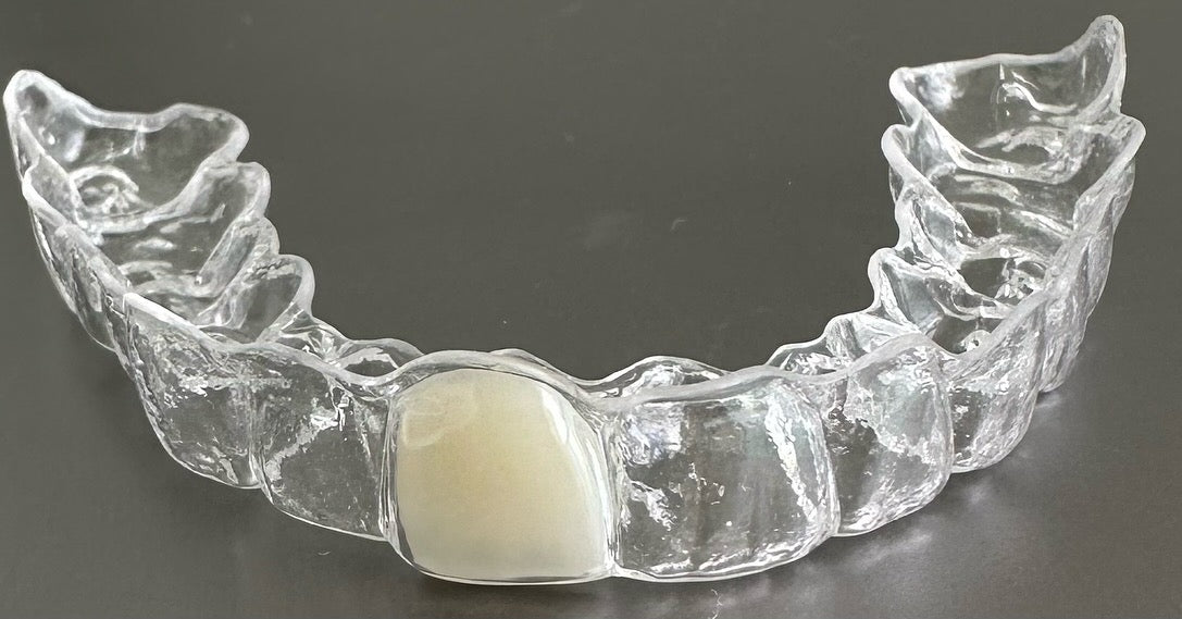 Essix Clear Retainer, Includes 1 Tooth – The Clear Guard